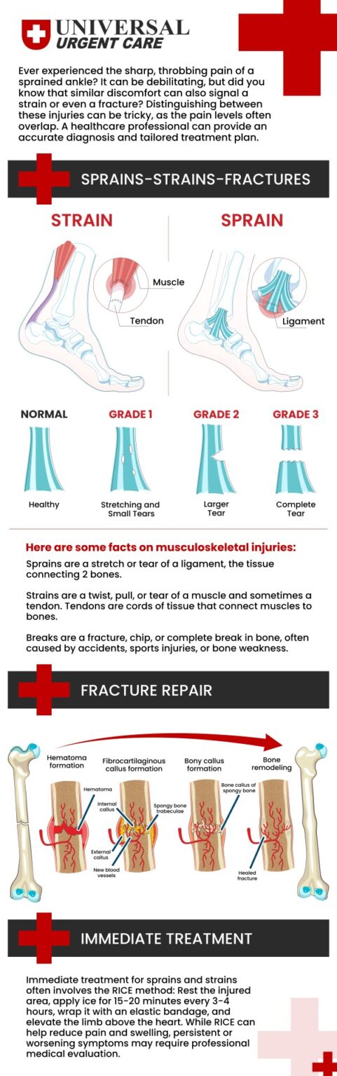 Sprains and Strains Treatment Near Me in Bakersfield, CA